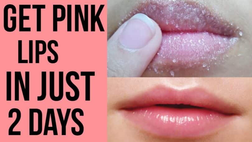 How To Naturally Make Your Lips Pink And Soft - citiMuzik