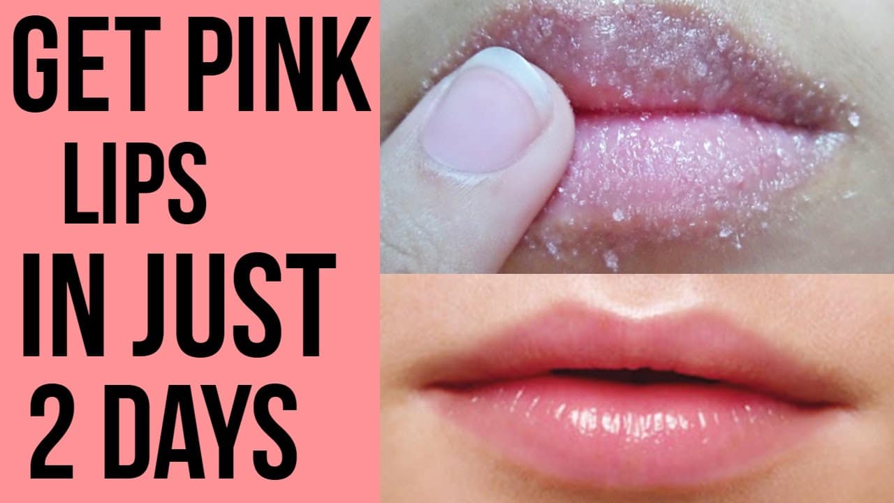 How To Naturally Make Your Lips Pink And Soft - citiMuzik