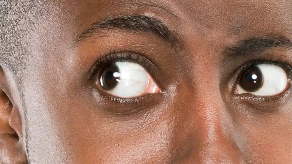 Bombastic Side Eye: The Meaning Behind the Expression - citiMuzik